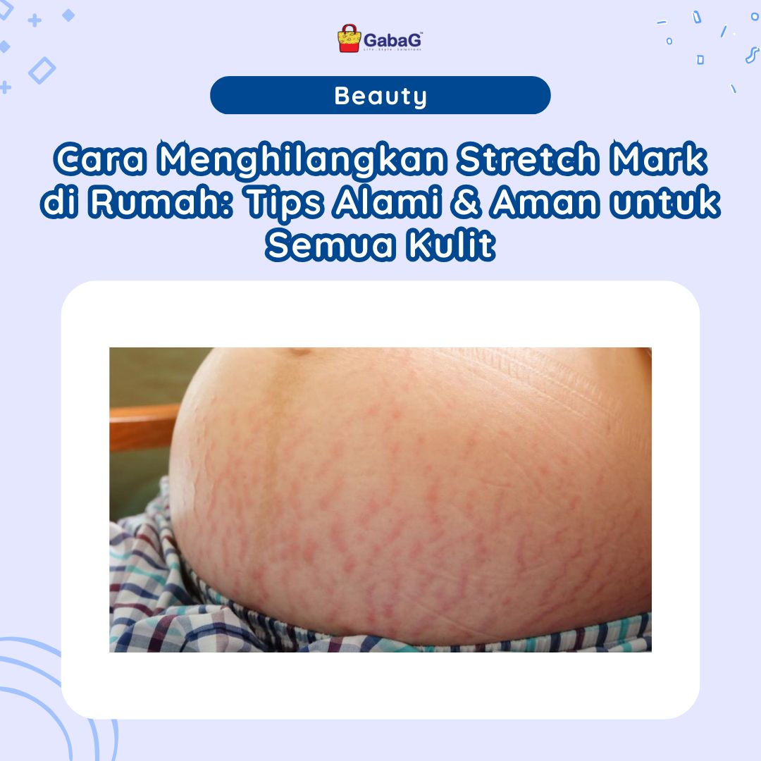 Cara Menghilangkan Stretch Mark di Rumah: Tips Alami & Aman untuk Semua ...
